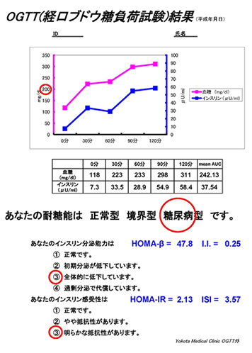 明石市【よこた内科クリニック】内科・糖尿病内科・腎臓内科｜糖尿病について-OGTT（経口糖負荷試験）外来